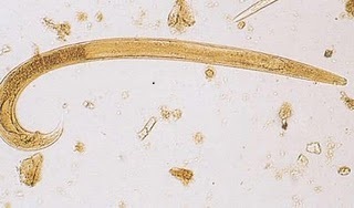 Wormen In Ontlasting